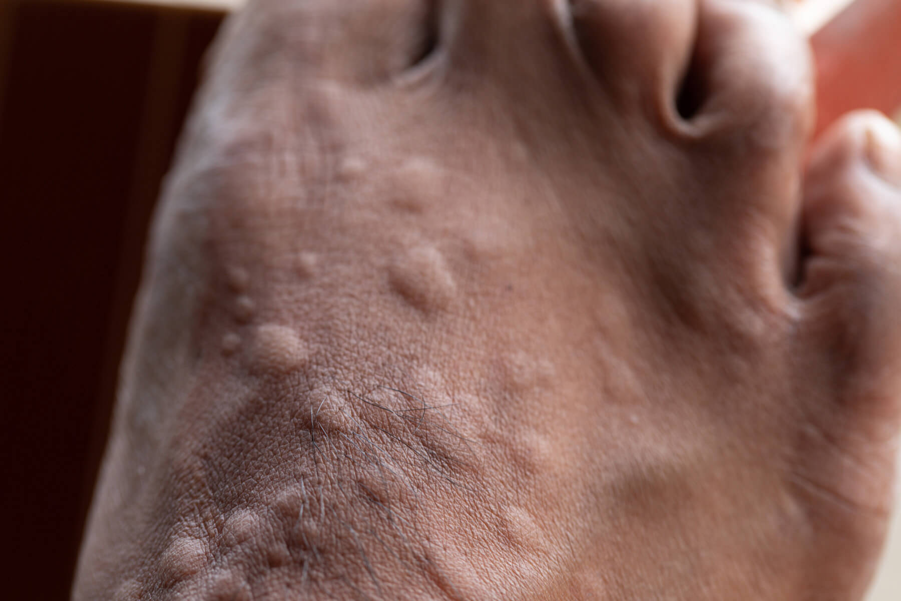 Fire Ant Removal & Control | Eradicating Fire Ants